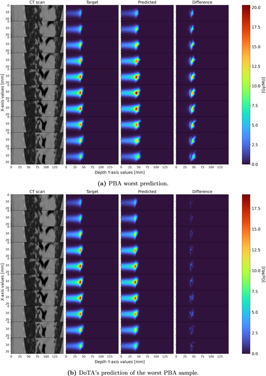 Millisecond speed deep learning based proton dose calculation with Monte Carlo accuracy - IOPscience