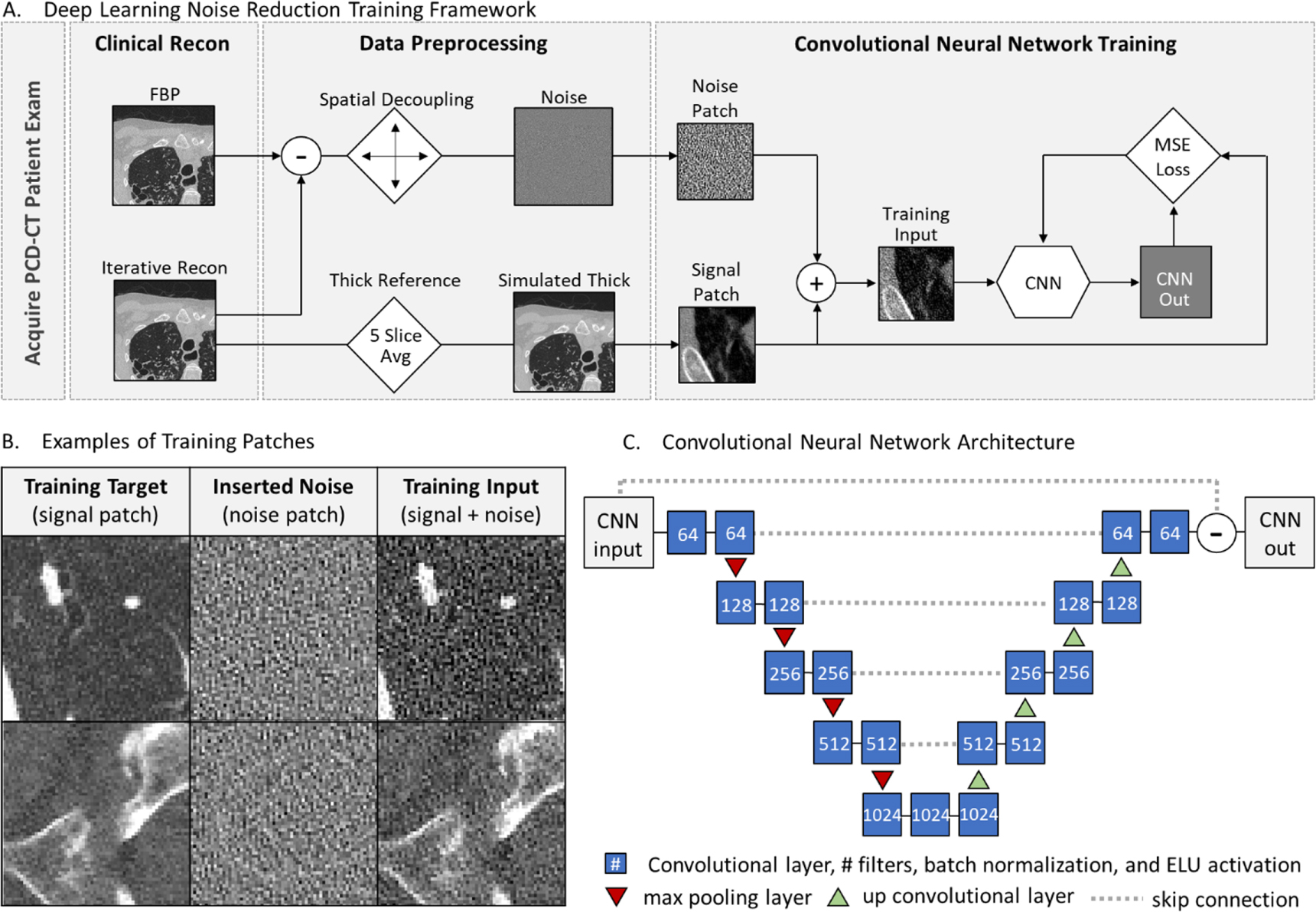 Dedicated convolutional neural network for noise reduction in ultra ...