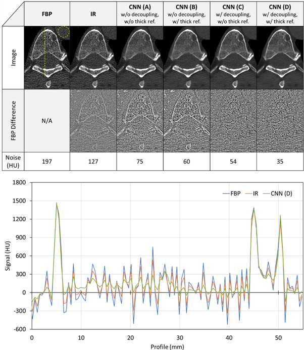 Dedicated convolutional neural network for noise reduction in ultra ...