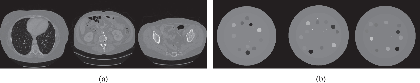 Generalized deep iterative reconstruction for sparse-view CT imaging ...