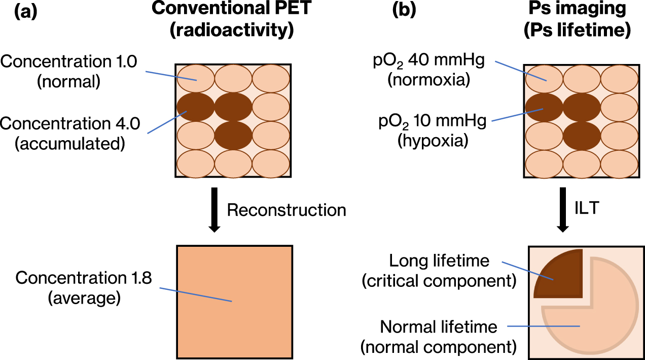 Using inverse Laplace transform in positronium lifetime imaging - IOPscience