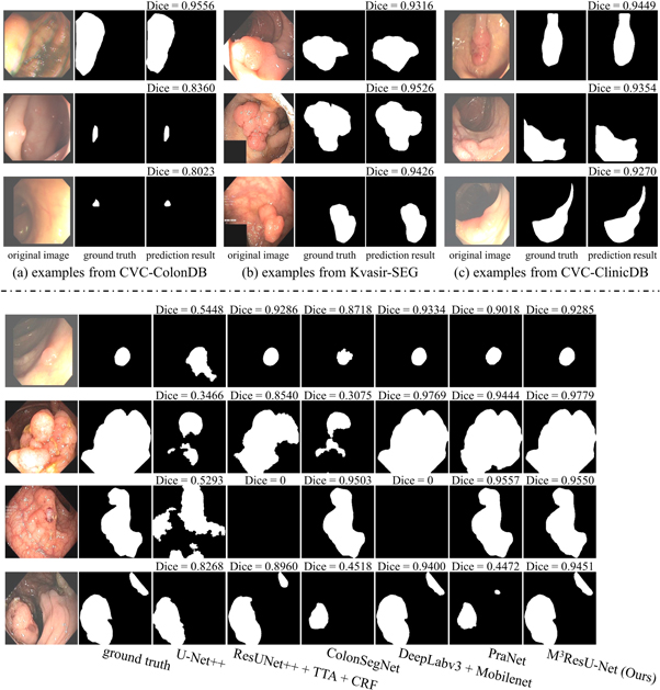 M3ResU-Net: a deep residual network for multi-center colorectal polyp segmentation based on ...