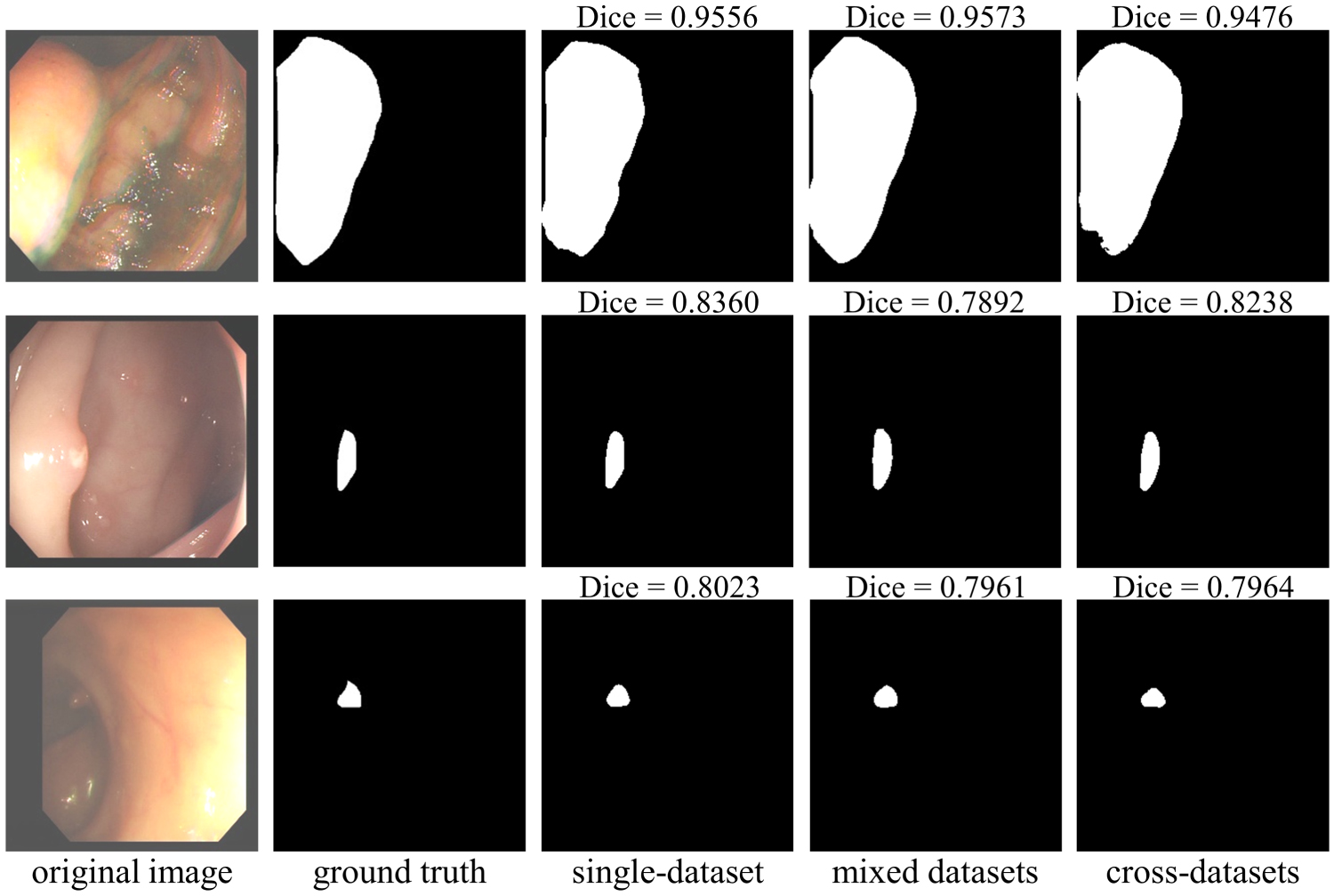 M3ResU-Net: a deep residual network for multi-center colorectal polyp ...