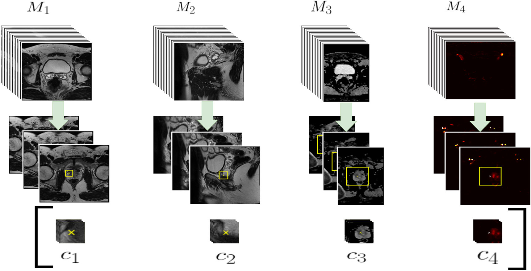 An inception-based deep multiparametric net to classify clinical ...