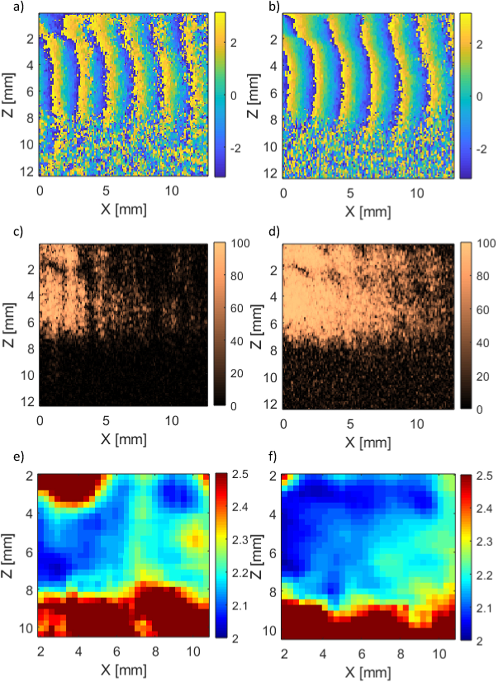 High frequency ultrasound vibrational shear wave elastography for ...