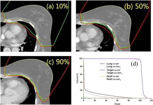 Improvement of proton beam range uncertainty in breast treatment using ...
