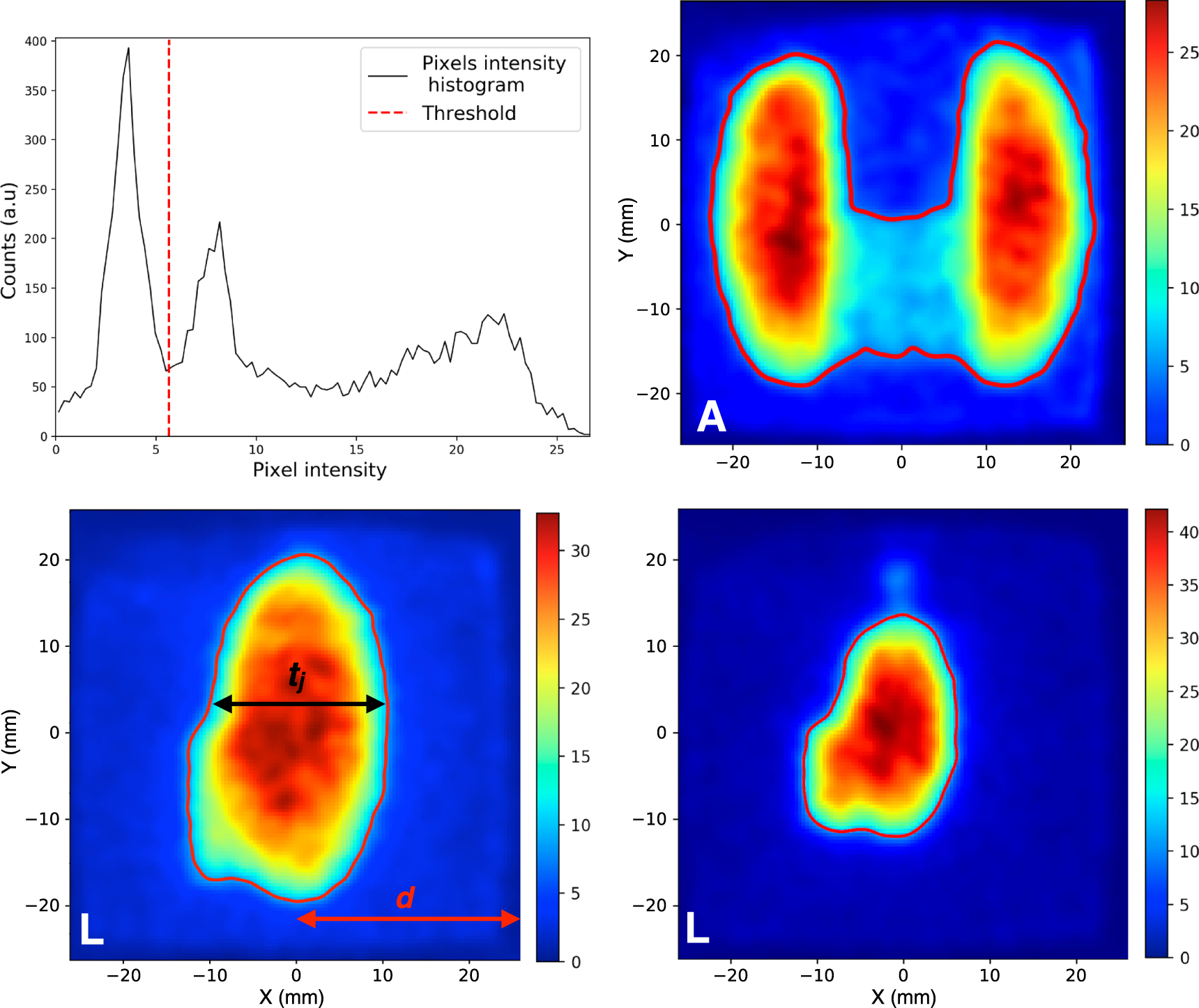 A mobile high-resolution gamma camera for therapeutic dose control ...