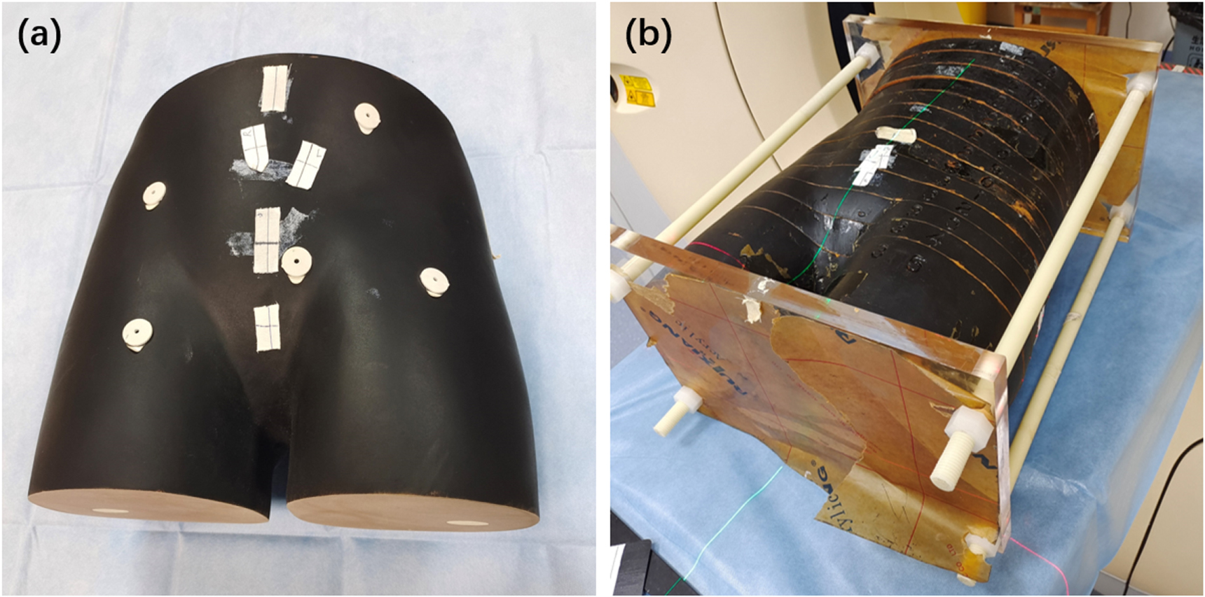A two-step method to improve image quality of CBCT with phantom-based ...