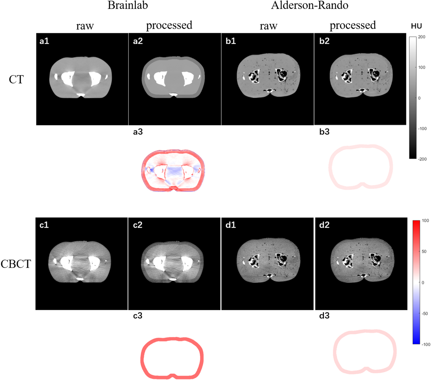A two-step method to improve image quality of CBCT with phantom-based ...