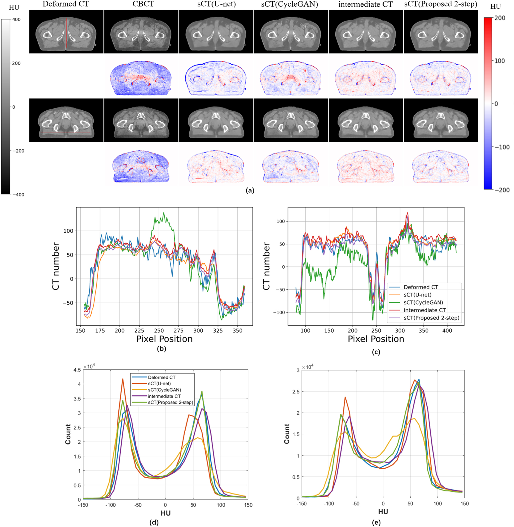 A two-step method to improve image quality of CBCT with phantom-based ...
