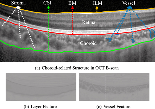 Synergistically segmenting choroidal layer and vessel using deep learning for choroid structure ...