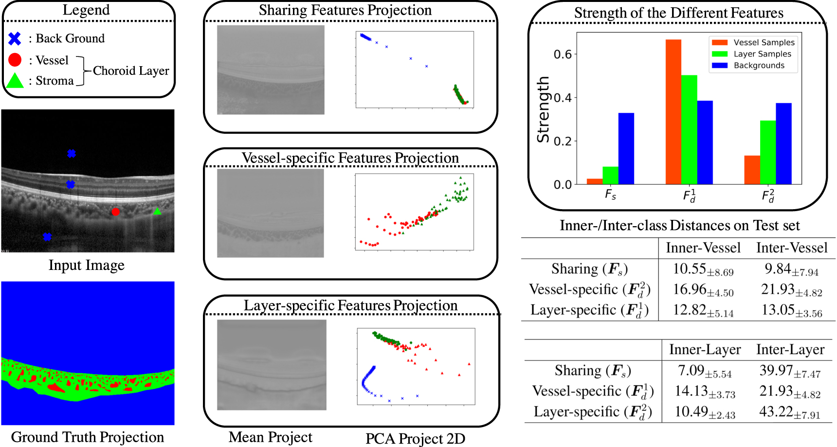 Synergistically segmenting choroidal layer and vessel using deep learning for choroid structure ...