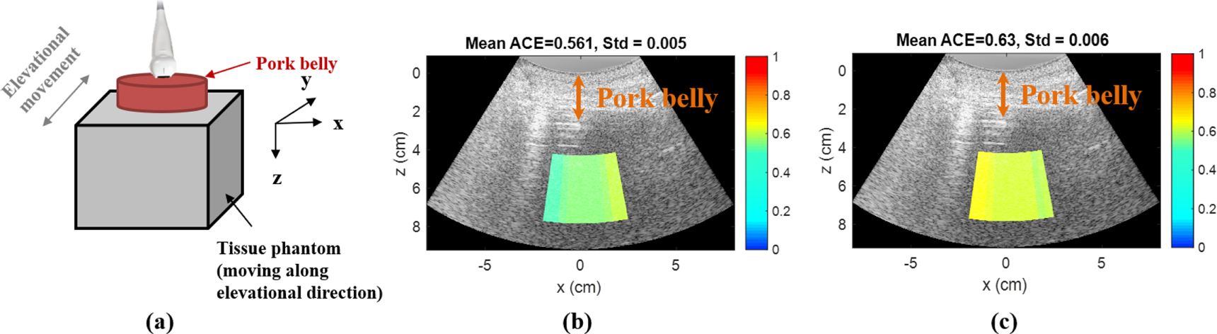 Reverberation clutter signal suppression in ultrasound attenuation ...