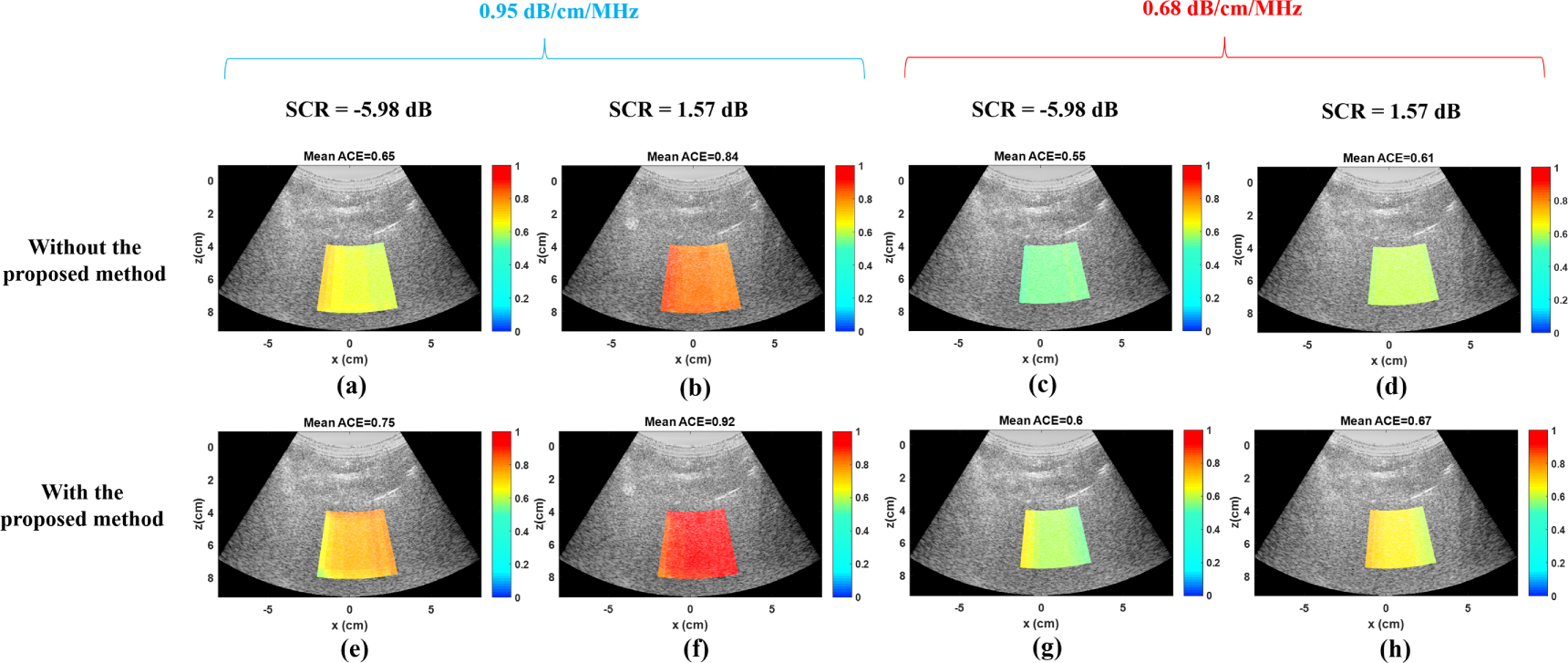 Reverberation clutter signal suppression in ultrasound attenuation ...