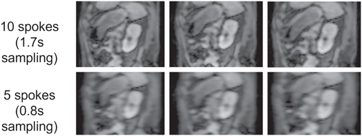 Real-time prediction of stomach motions based upon gastric contraction ...