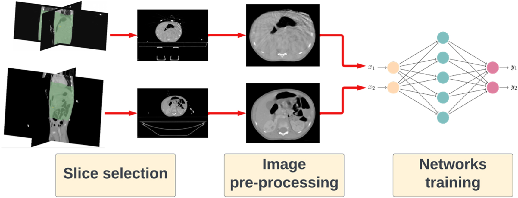 Deep learning based synthetic CT from cone beam CT generation for ...