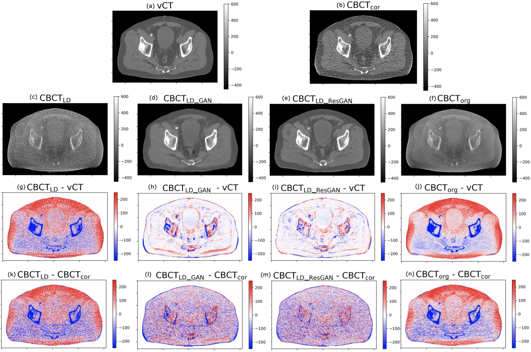 Feasibility of CycleGAN enhanced low dose CBCT imaging for prostate ...