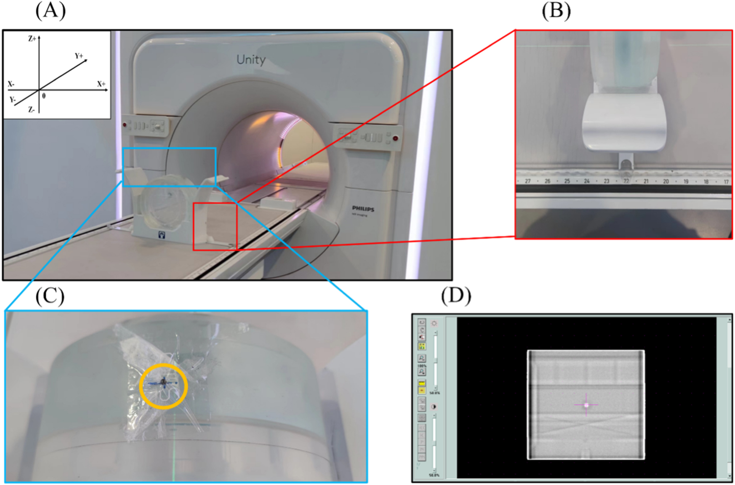 Influence of different factors on registration error in a 1.5 T MR ...