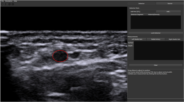 A graphical user interface for calculating the arterial input function during dynamic positron ...