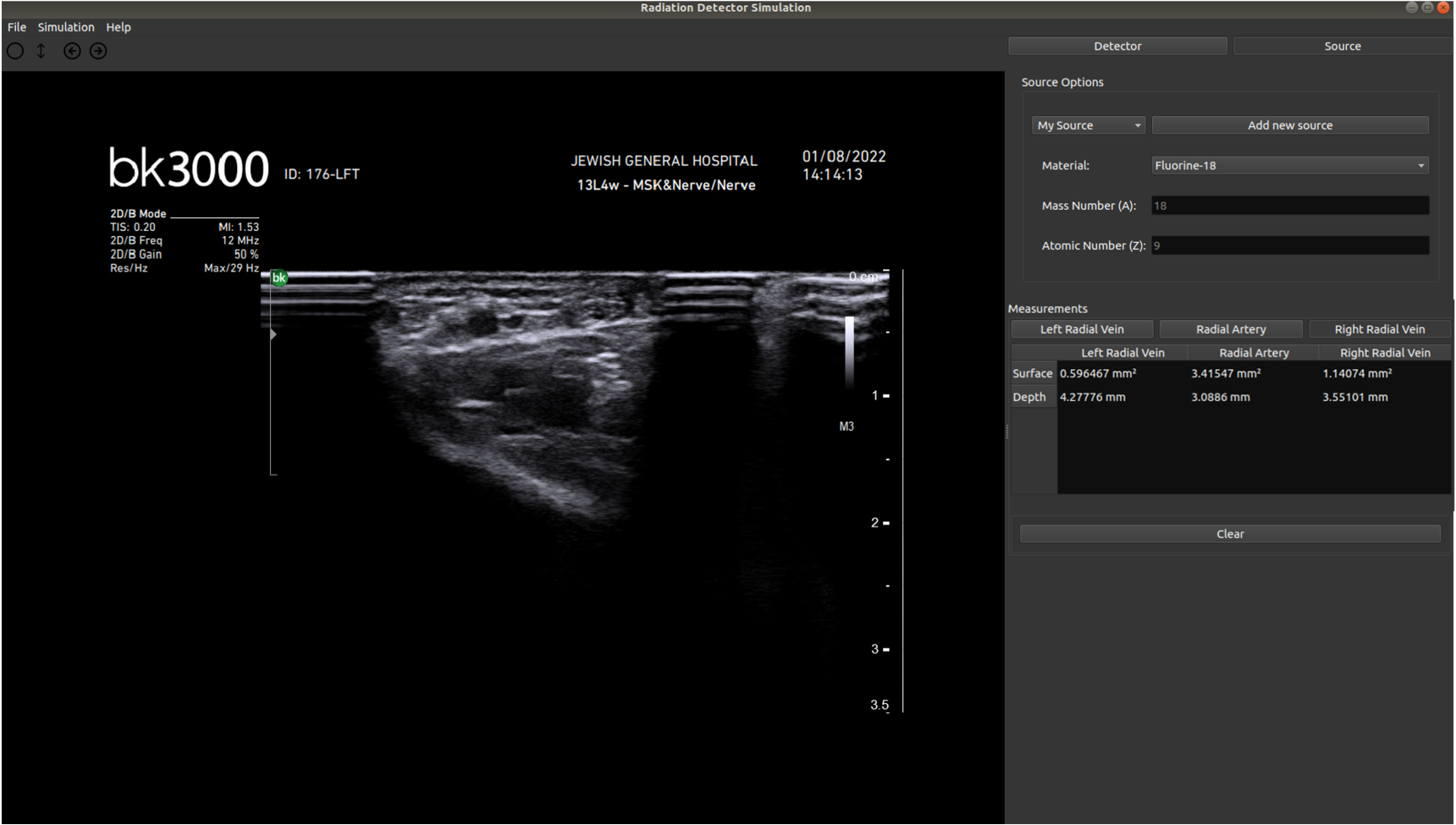 A graphical user interface for calculating the arterial input function during dynamic positron ...