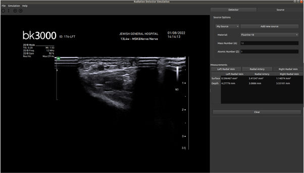 A graphical user interface for calculating the arterial input function during dynamic positron ...