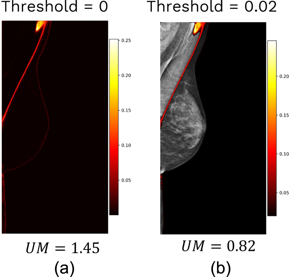 Uncertainty estimation for deep learning-based pectoral muscle ...