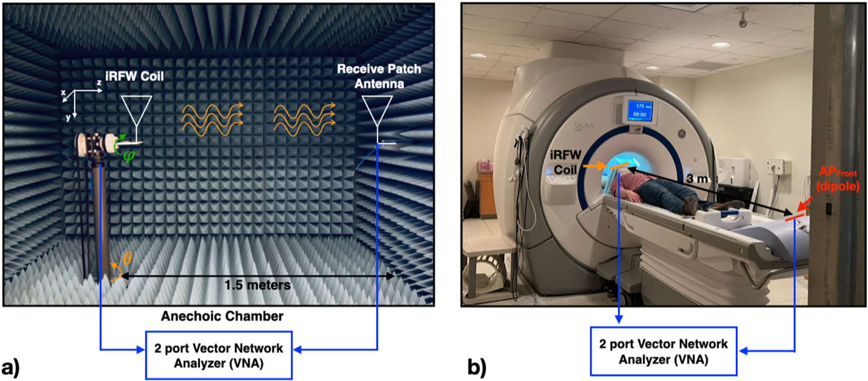 Numerical simulations of an integrated radio-frequency/wireless coil ...