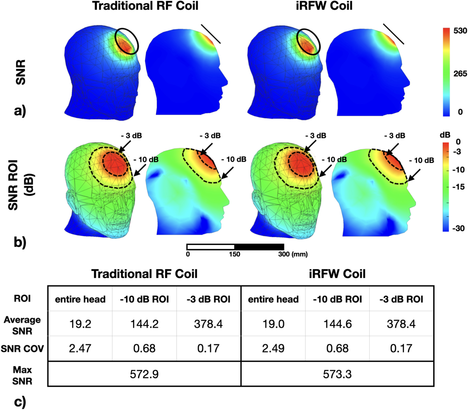 Numerical simulations of an integrated radio-frequency/wireless coil ...