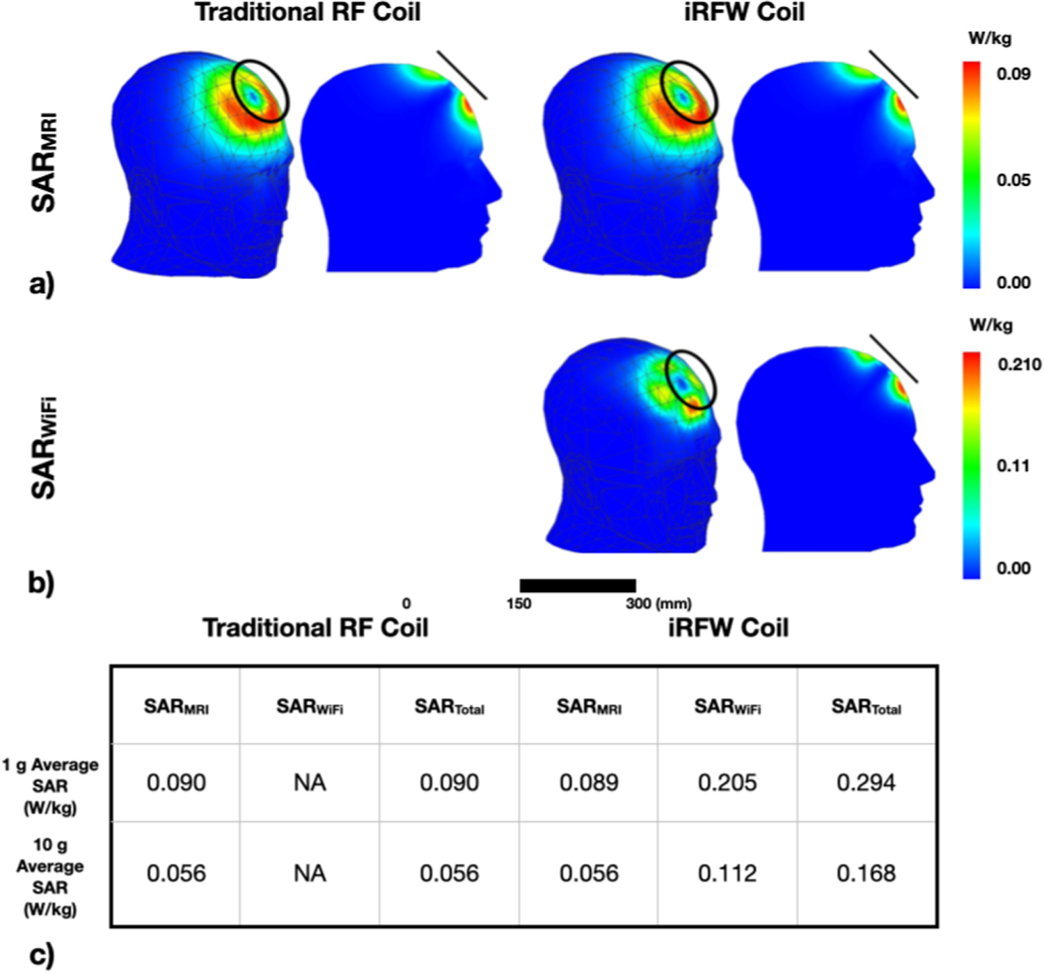 Numerical simulations of an integrated radio-frequency/wireless coil ...