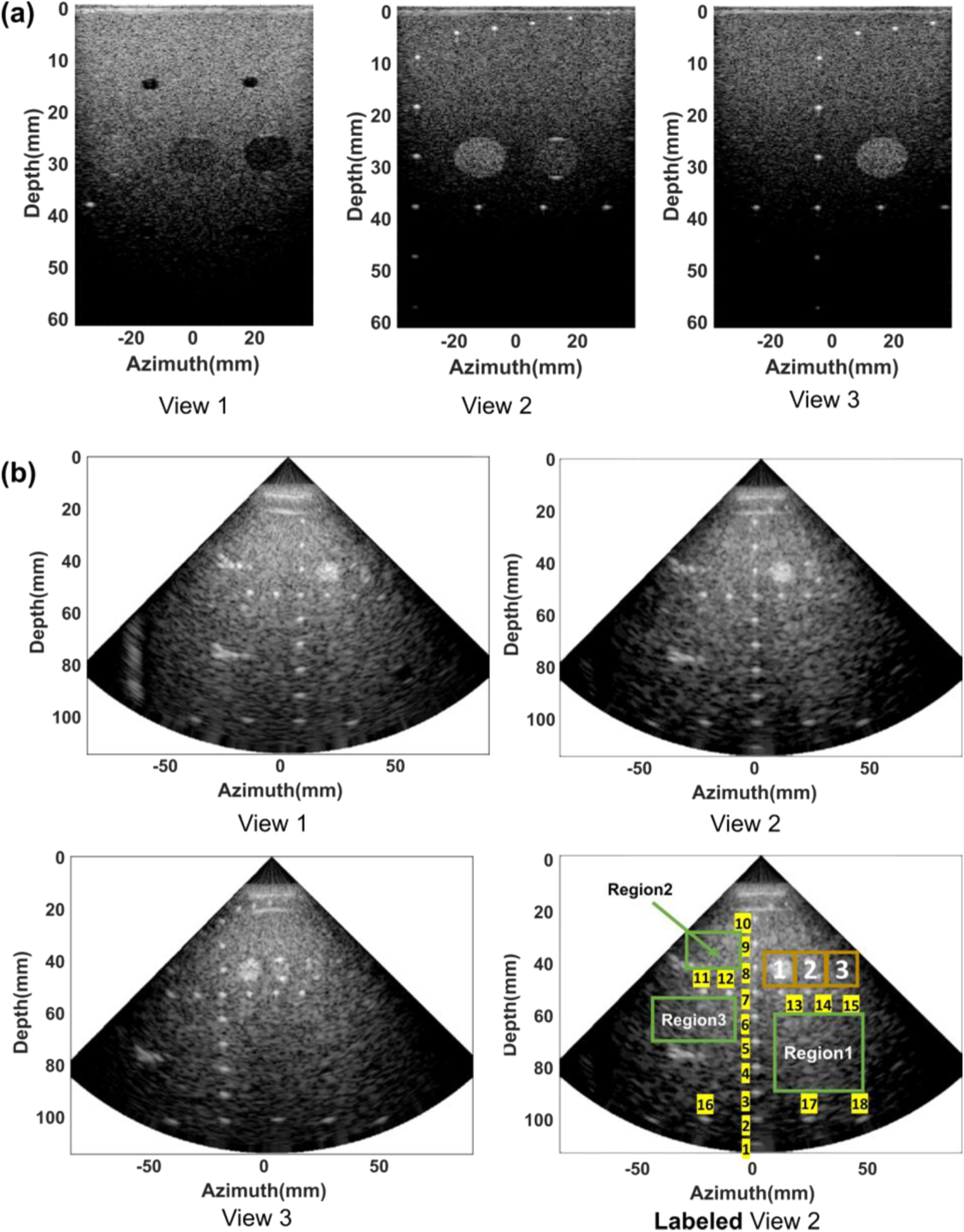 Constrained CycleGAN for effective generation of ultrasound sector ...