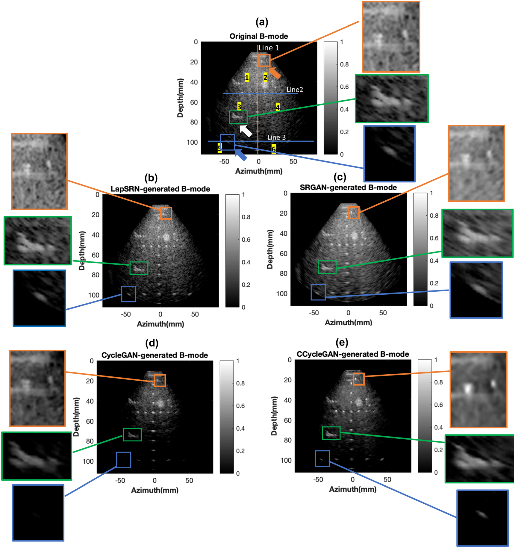Constrained CycleGAN for effective generation of ultrasound sector ...