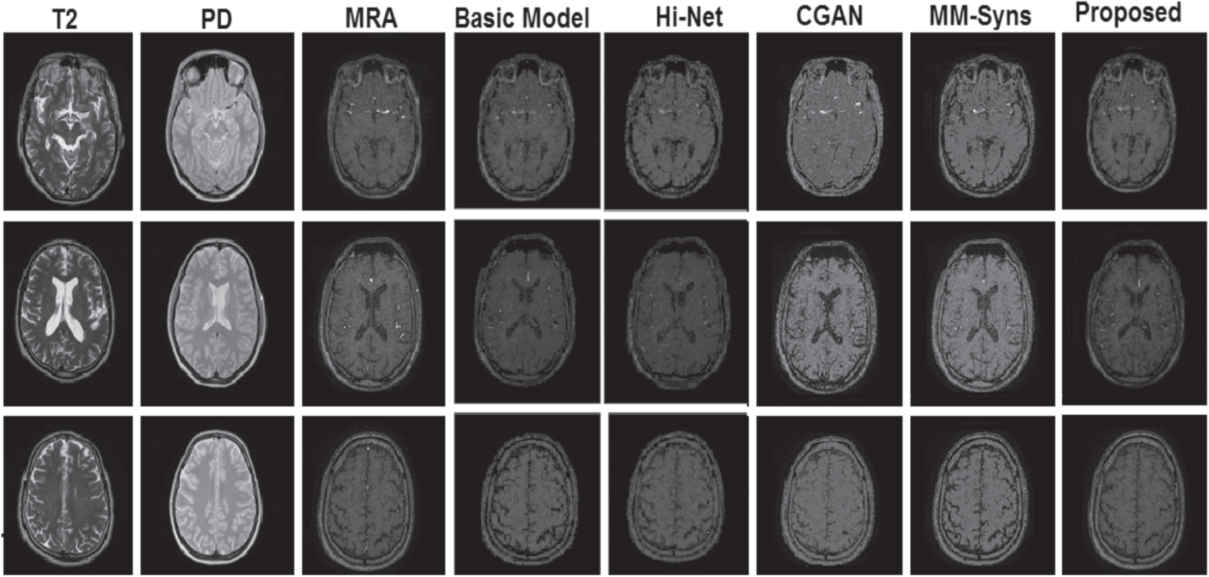 Bidirectional feature matching based on deep pairwise contrastive ...