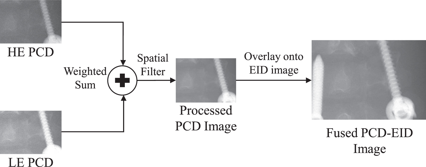 Photon counting-energy integrating hybrid flat panel detector systems ...