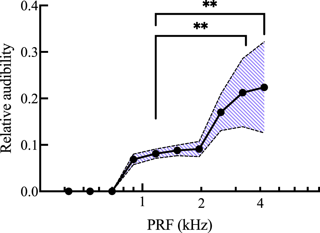 Investigating the impact of skull vibrations on motor responses to ...