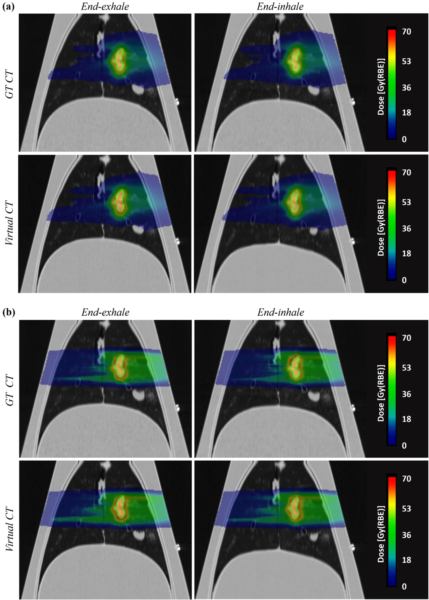 Virtual 4DCT generated from 4DMRI in gated particle therapy: phantom ...