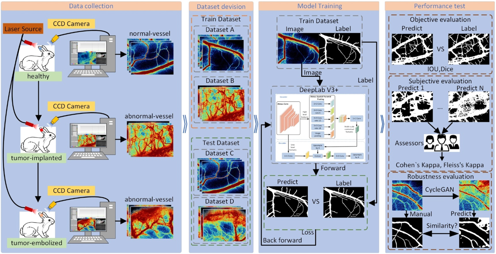 Robust vessel segmentation in laser speckle contrast images based on semi-weakly supervised ...