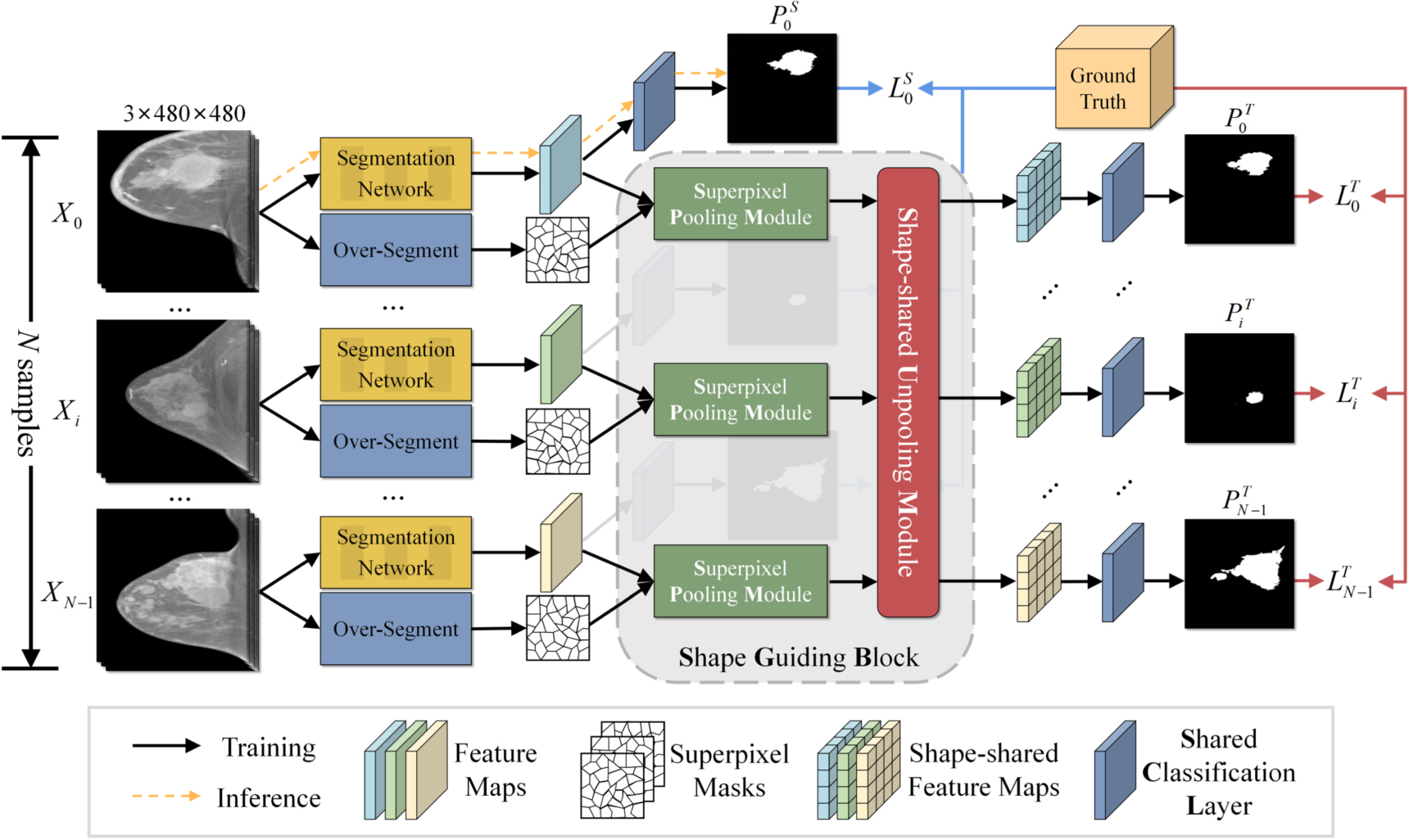 Improving breast tumor segmentation via shape-wise prior-guided information on cone-beam breast ...