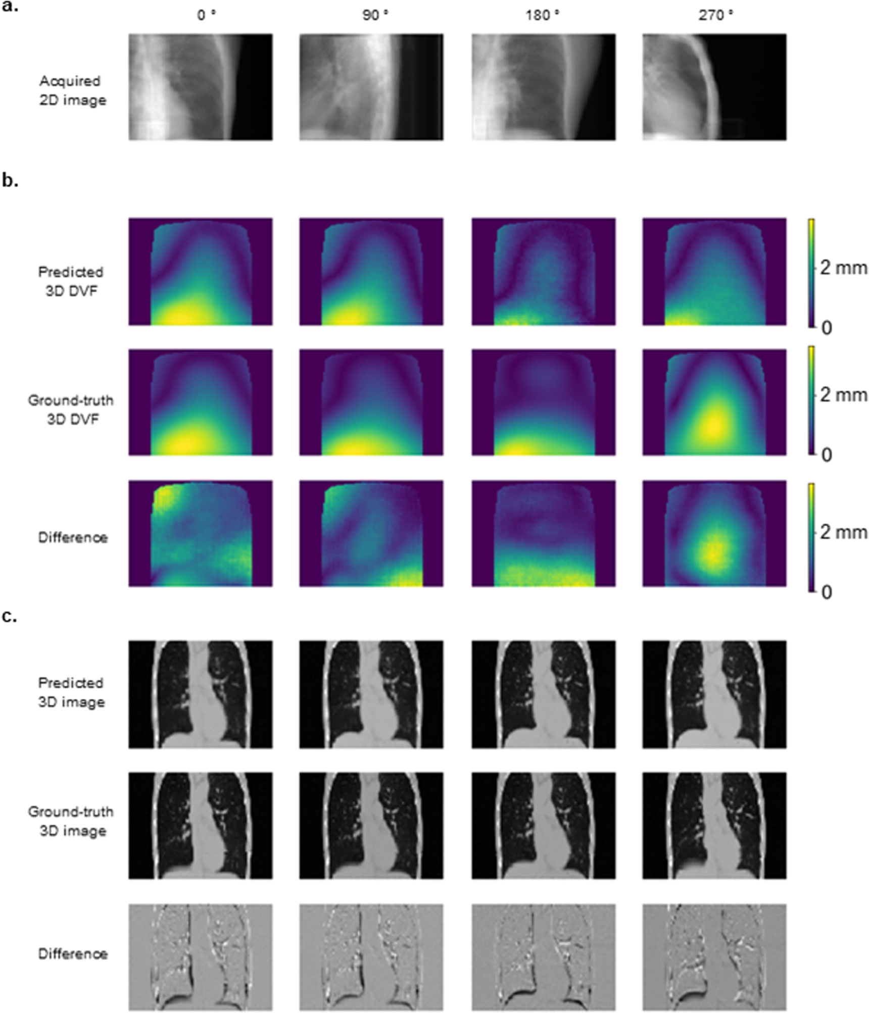 A Patient Specific Deep Learning Framework For 3d Motion Estimation And Volumetric Imaging