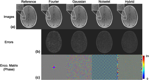 Recent advances in highly accelerated 3D MRI - IOPscience