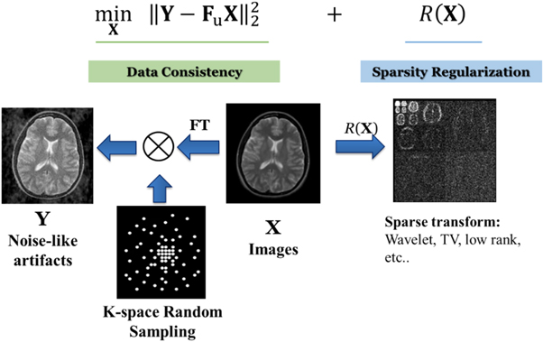 Recent advances in highly accelerated 3D MRI - IOPscience