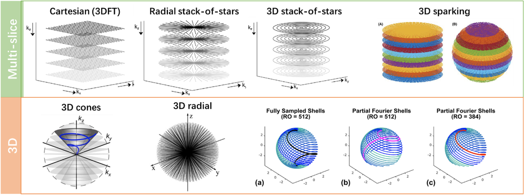 Recent advances in highly accelerated 3D MRI - IOPscience