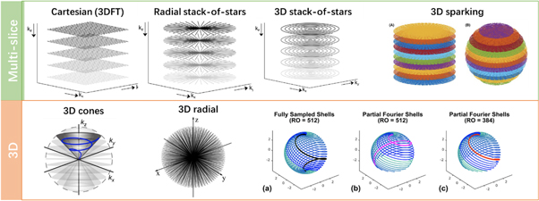 Recent advances in highly accelerated 3D MRI - IOPscience