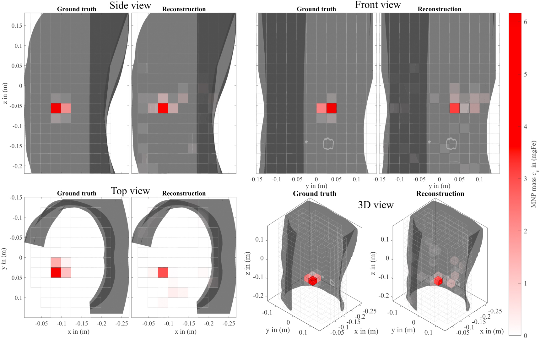 Human-sized quantitative imaging of magnetic nanoparticles with ...