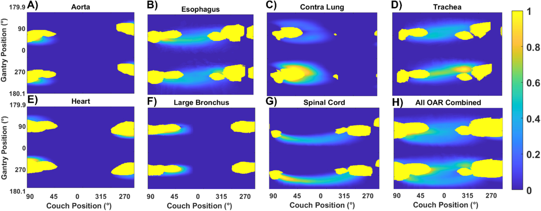 Static couch non-coplanar arc selection optimization for lung SBRT ...
