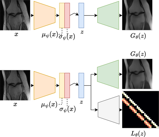 VAEs with structured image covariance applied to compressed sensing MRI ...