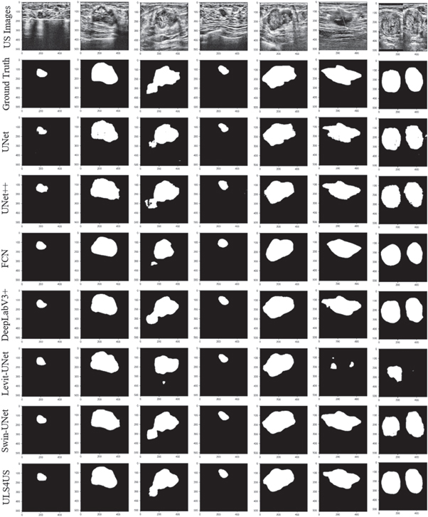 ULS4US: universal lesion segmentation framework for 2D ultrasound ...