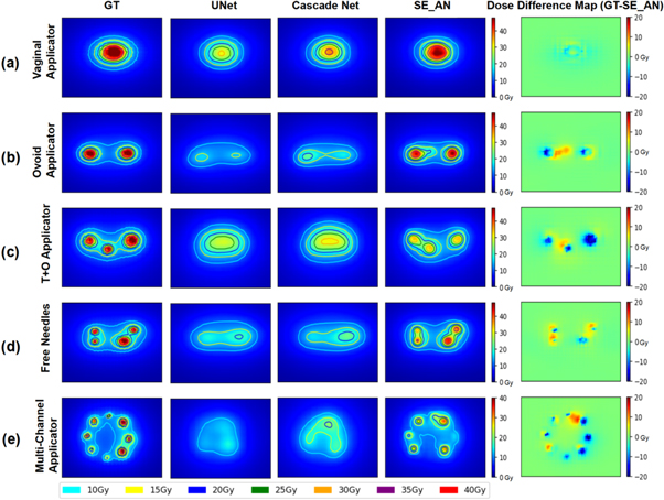 Deep learning-based dose map prediction for high-dose-rate brachytherapy - IOPscience