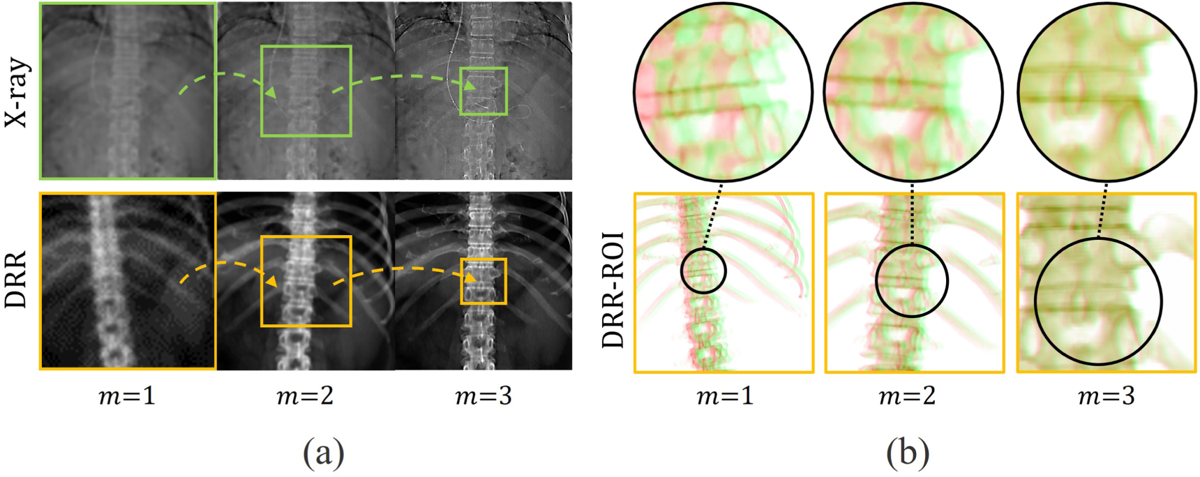 CT2X-IRA: CT to x-ray image registration agent using domain-cross multi ...