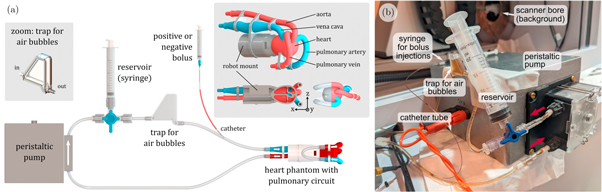 Saline bolus for negative contrast perfusion imaging in magnetic ...