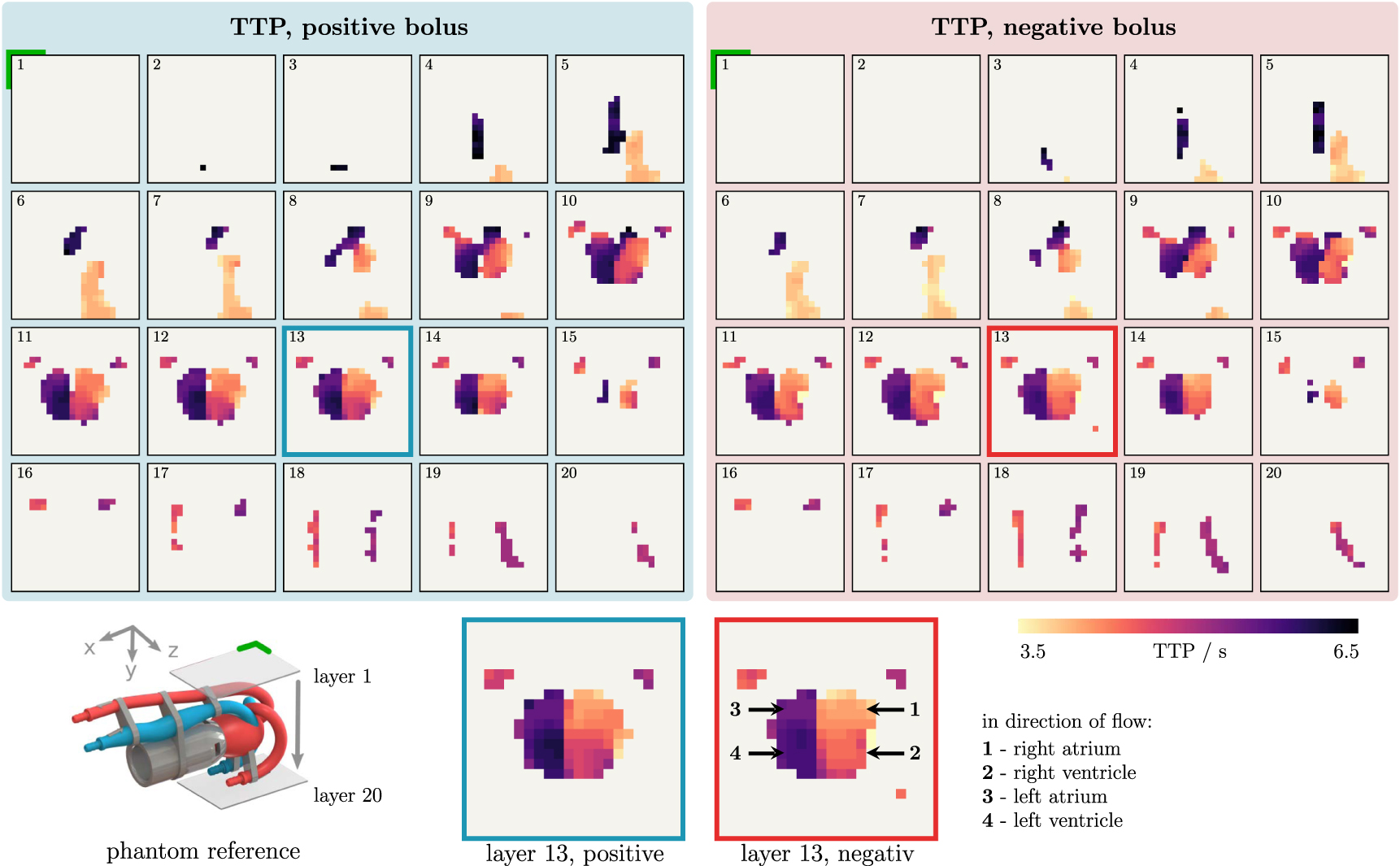 Saline bolus for negative contrast perfusion imaging in magnetic ...